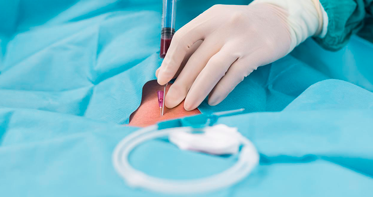 Sanatorio Parque | Punciones